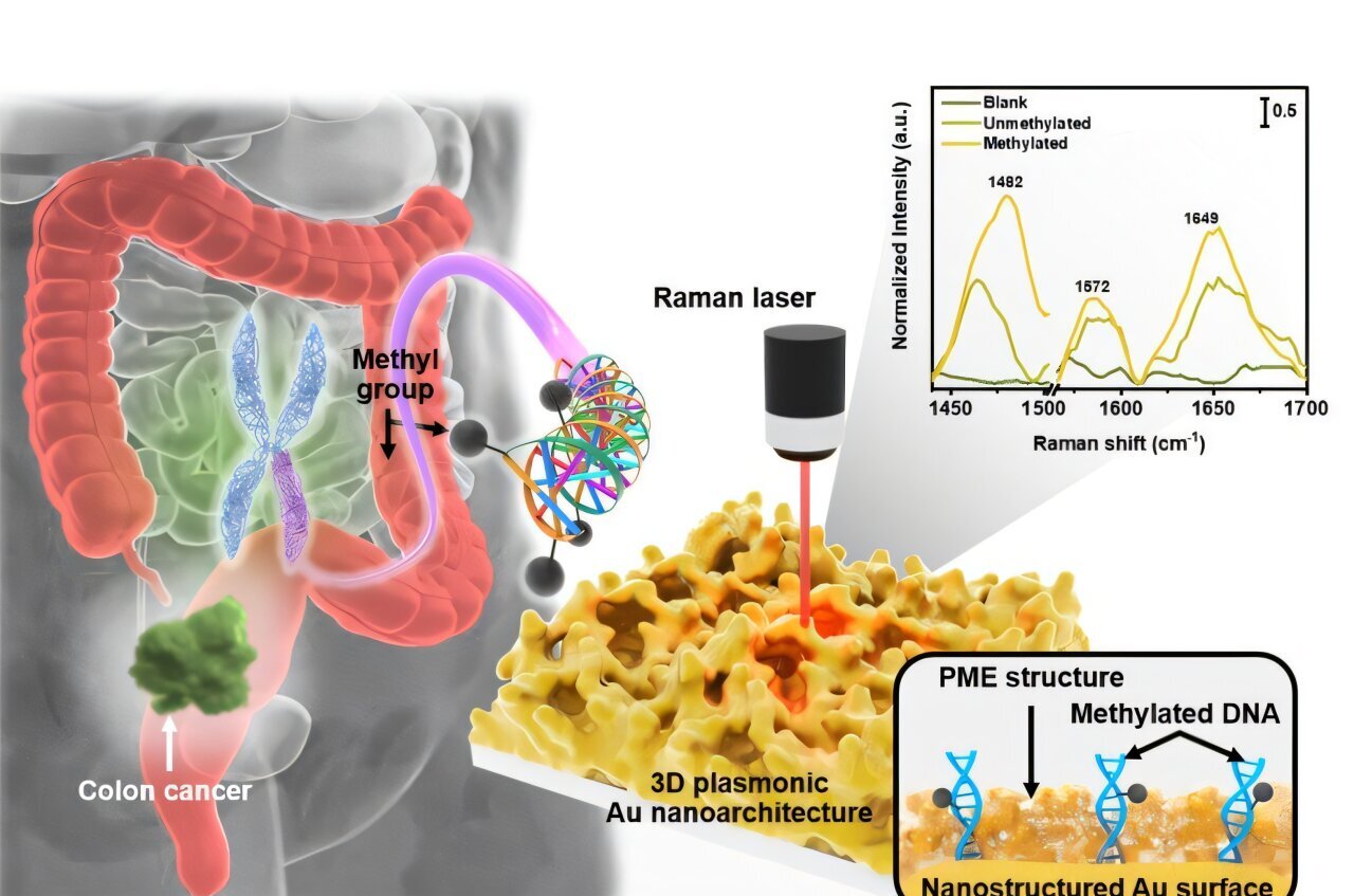Researchers develop biosensor based on light and AI for early diagnosis ...