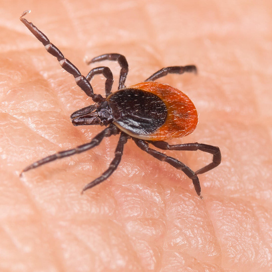 Tick bites are causing a spike in ER visits this year. Experts explain why.