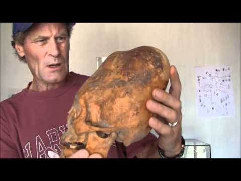 Enormous Cone Head of Paracas, Peru: Lost Human History Revealed