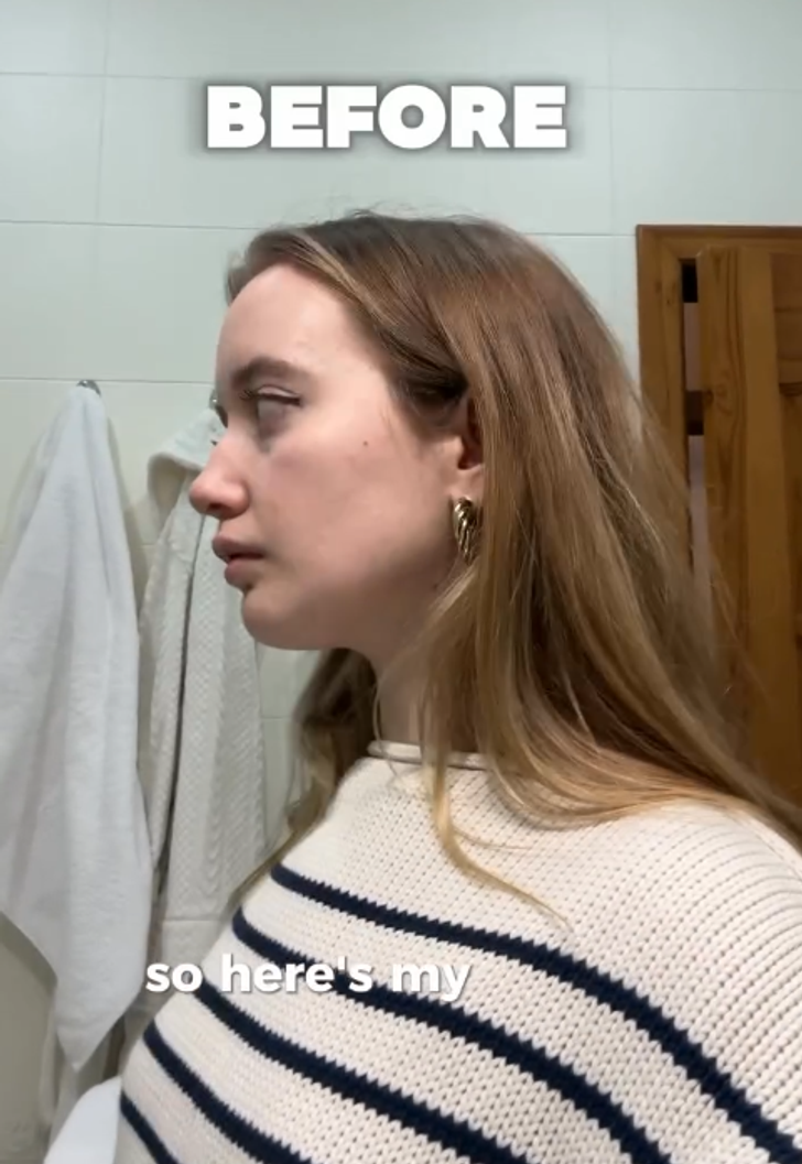 Singer Travels 24 Hours for Jaw Surgery and Shocks Everyone With the Result