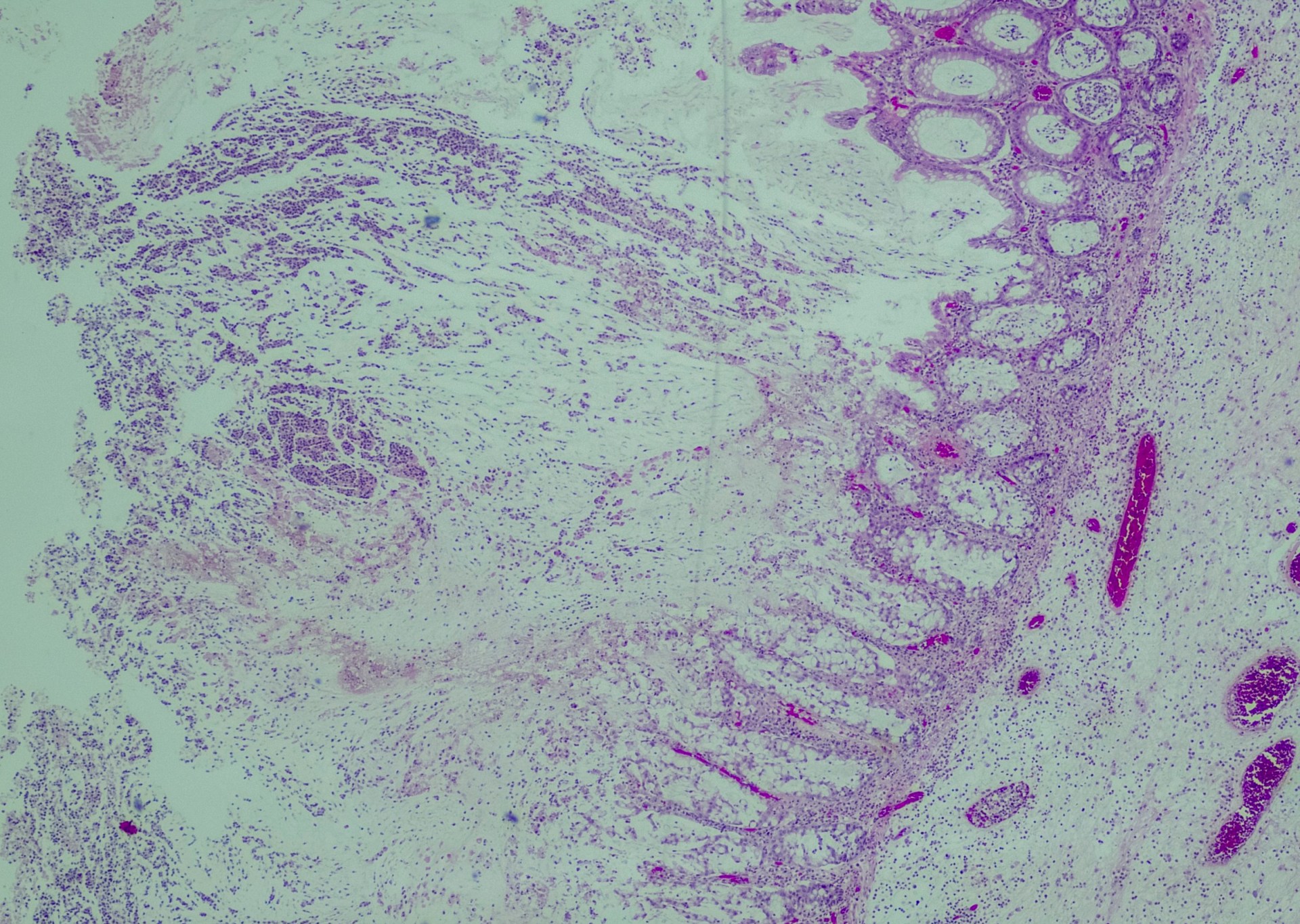 Deadly C. diff infections soar to 12 year high in UK