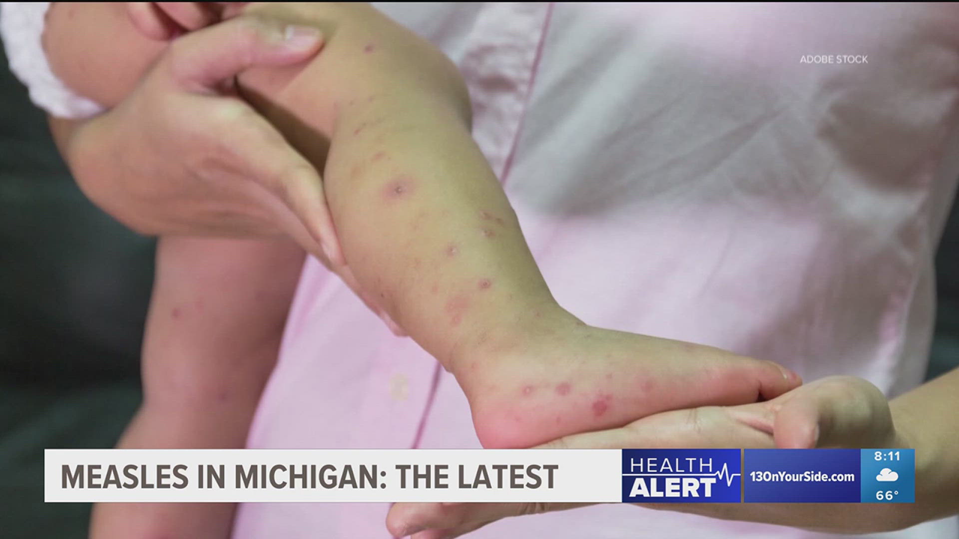 The latest on measles in Michigan as US sees increase in cases