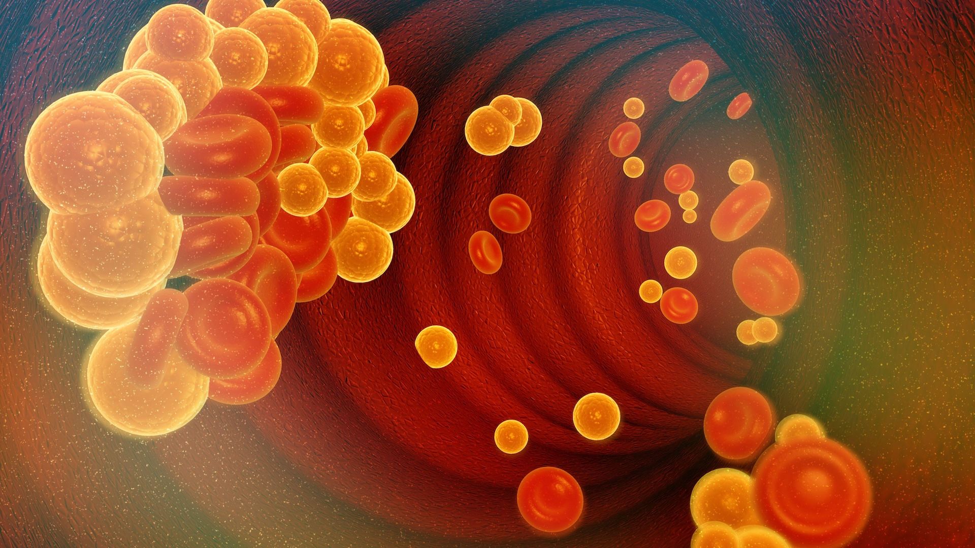 Experimental treatment for high cholesterol edits DNA in the body to ...