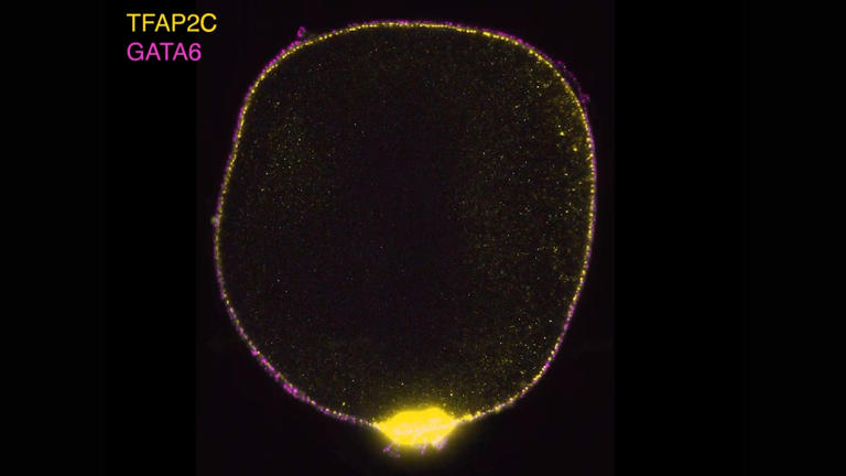 Scientists grow mini amniotic sacs in the lab using stem cells