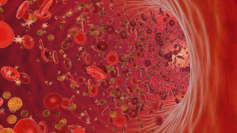 If You Have This Blood Type, You Could Be At Greater Risk For A Painful ...