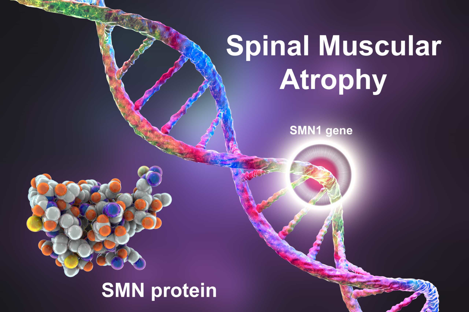 Understanding the effects of spinal muscular atrophy
