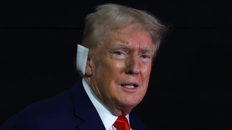 Plastic Surgeon Tells Us Why Trump's Ear Looks 'Impressive' One Year ...