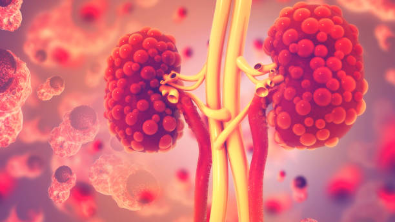 Donating a kidney? Here’s why you’ll be just fine (common myths debunked)