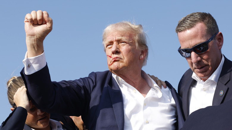 Plastic Surgeon Walks Us Through Trump's Ear Injury One Year After ...