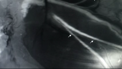 UNMH researchers testing nerve “glowing” drug