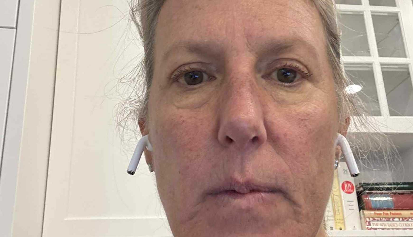 'High-Dose Turmeric Supplement Nearly Killed Me:' Mom Hopes Her Story ...