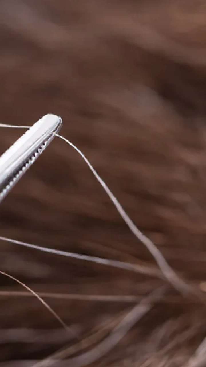 Does Pulling One White Hair Cause More to Grow?