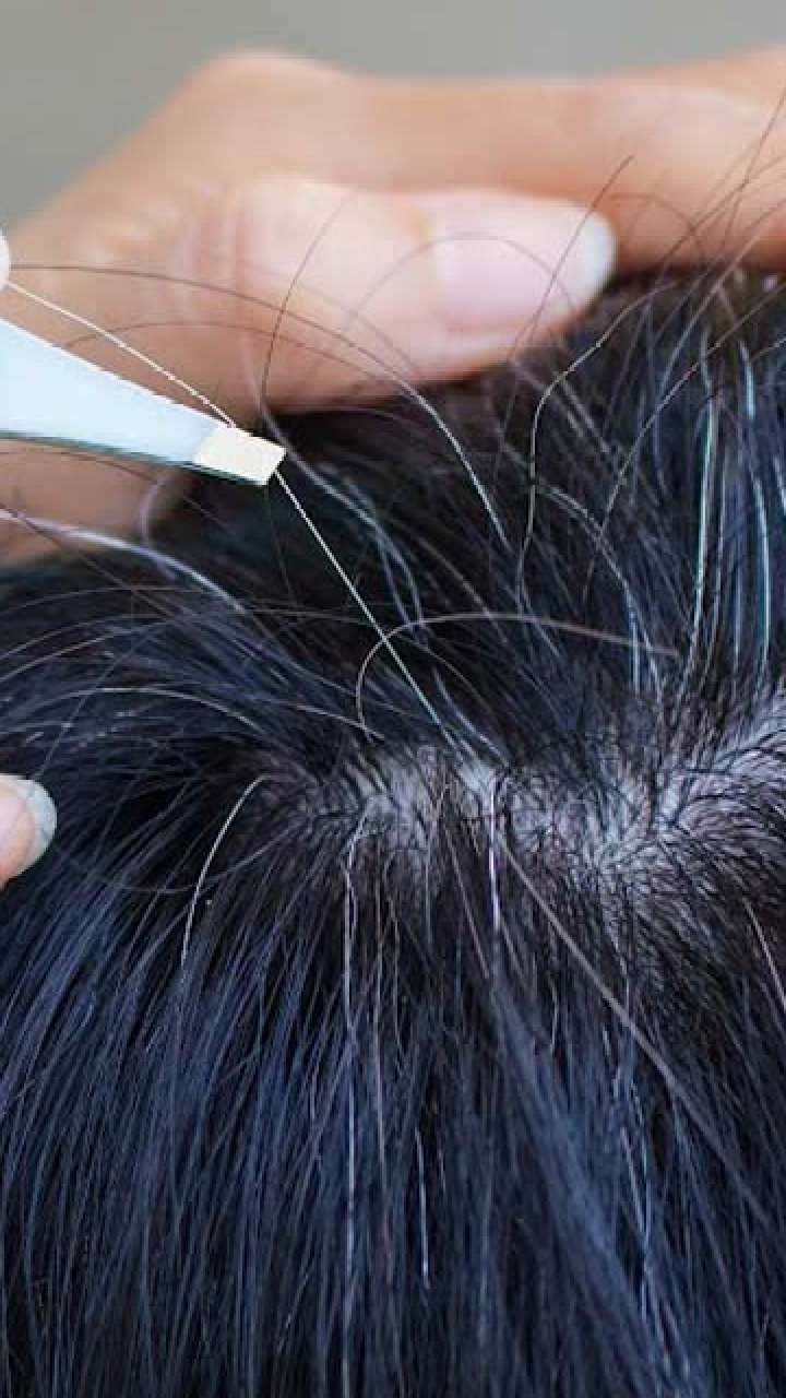 Does Pulling One White Hair Cause More to Grow?