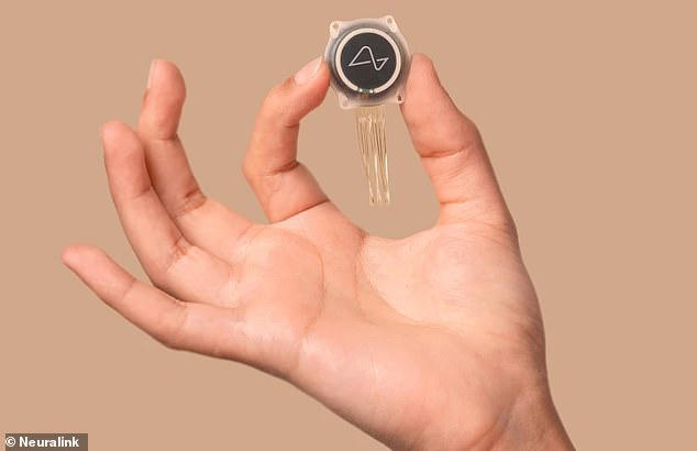 Paralyzed patient's incredible mind-control superpower after getting ...