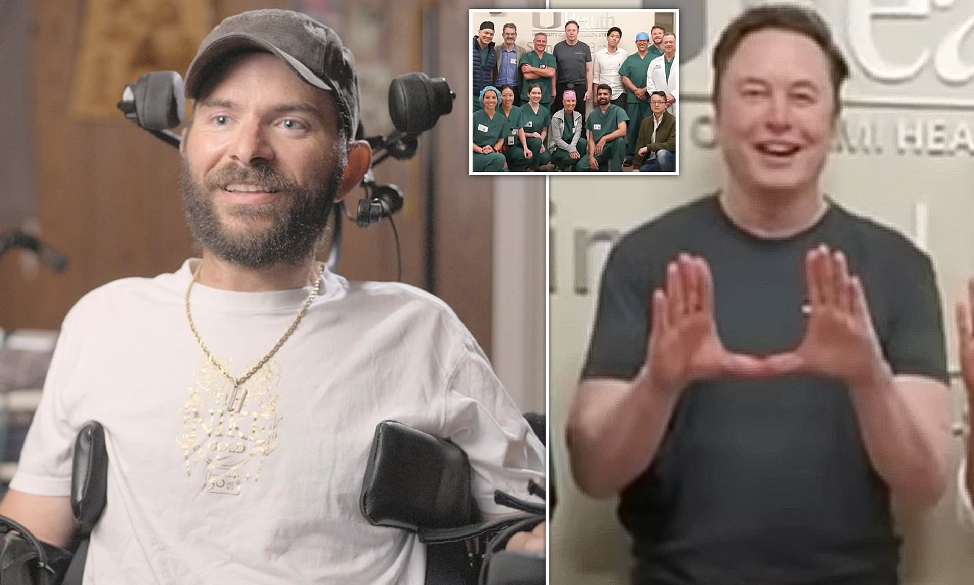 Paralyzed patient's incredible mind-control superpower after getting ...