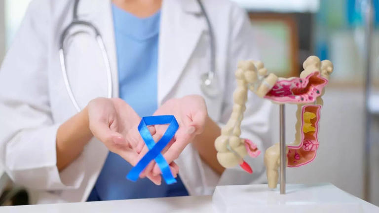 Colon cancer rising among youngsters: Top US doc alerts about 5 warning ...