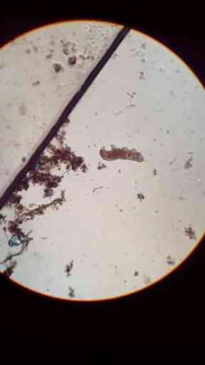 Barry the Tardigrade, Moss Pig or Waterbear