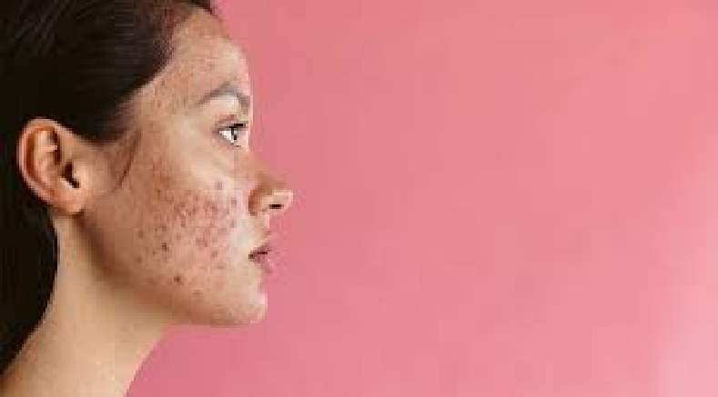 Does diet also affect skin color? How much truth is there in this.