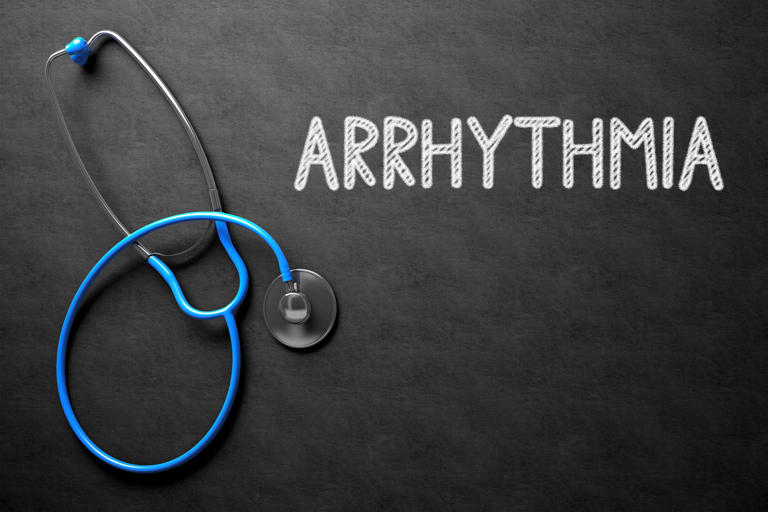 What is arrhythmia and what are the symptoms? A doctor explains