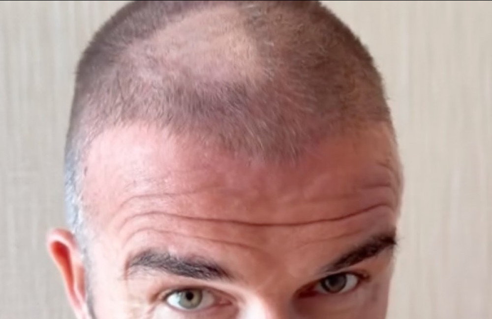 David Beckham left with huge bald patch after DIY haircut blunder
