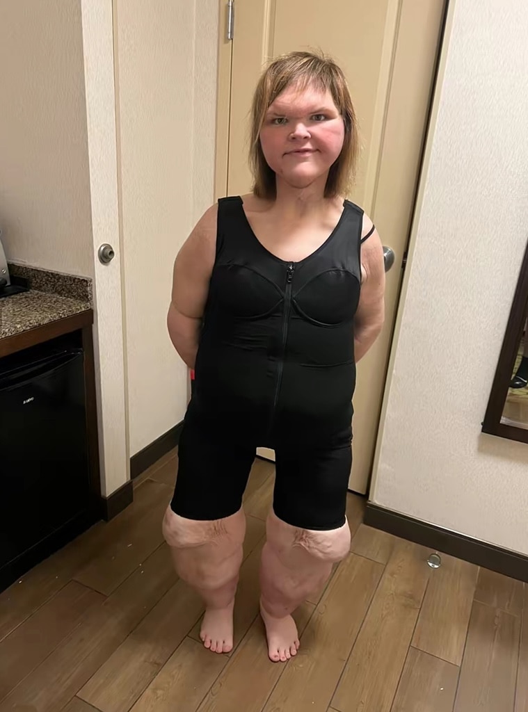 How Fame Changed Everything for 1000-Lb. Sisters Star Tammy Slaton