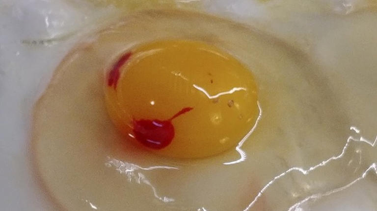Is It Safe To Eat Eggs That Have A Blood Spot?