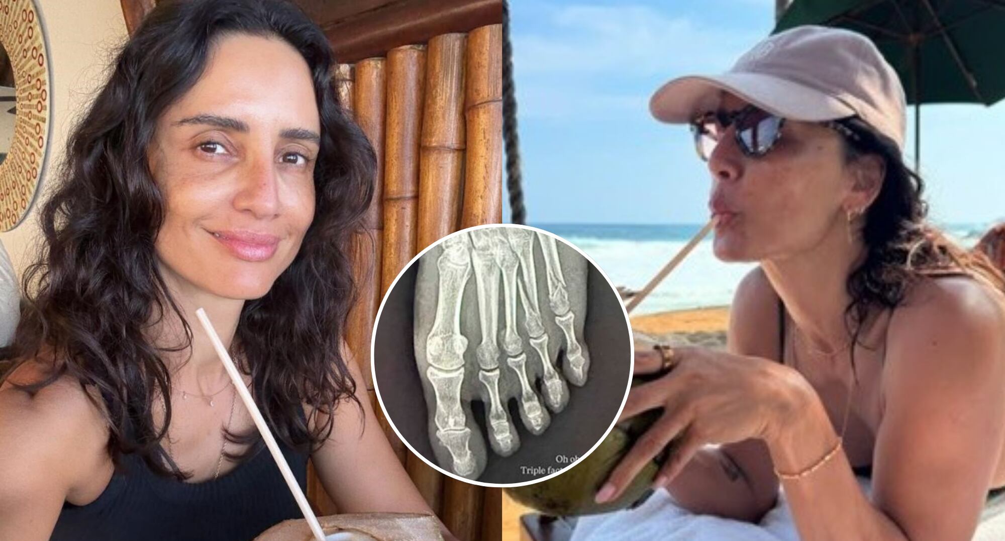 Leonor Varela sufrió grave accidente durante sus vacaciones en México ...