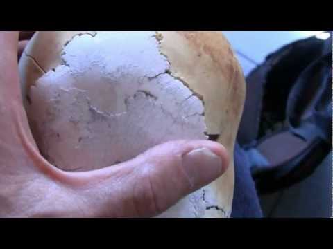 Inside The Elongated Cone Head Skulls Of Paracas Peru