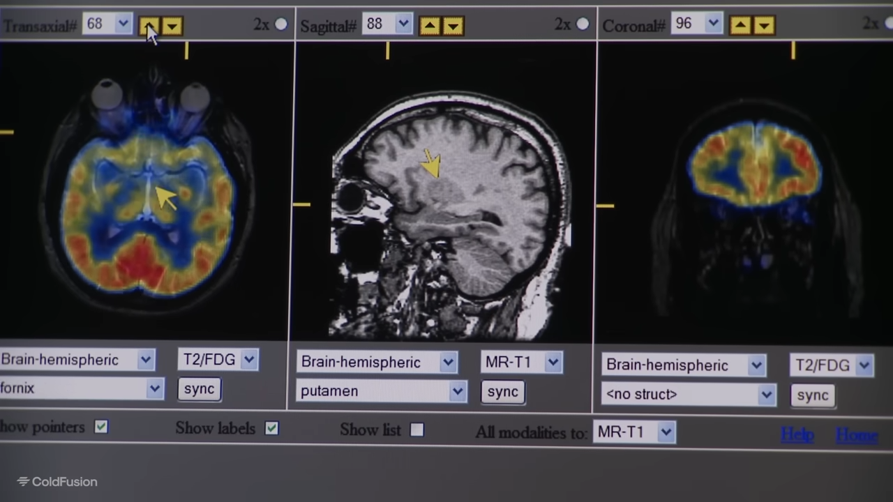 Meta’s AI reads minds using brain scans