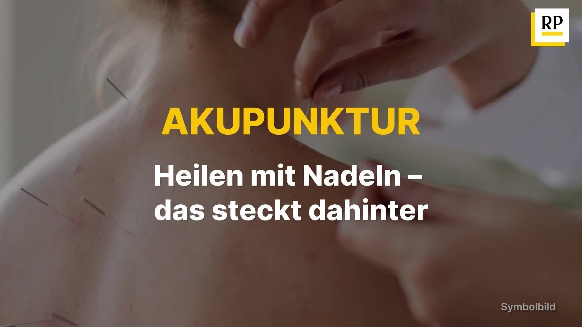 Akupunktur: Heilen mit Nadeln – das steckt dahinter