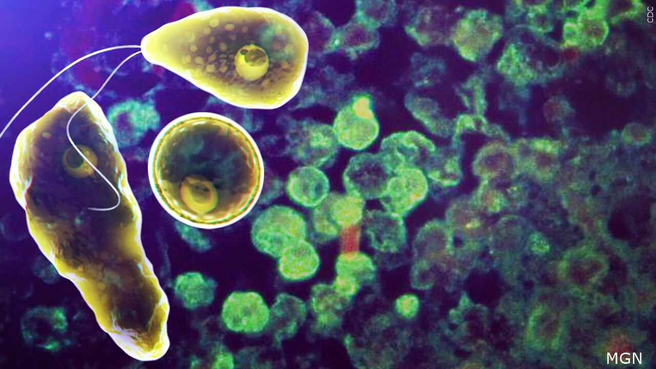 Department of Public Health confirms case of brain-eating amoeba in ...