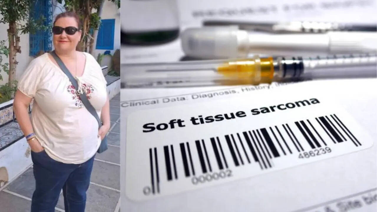 Rare, Weird Swellings in Man's Fingers and Toes Lead to Full-Blown Lung ...