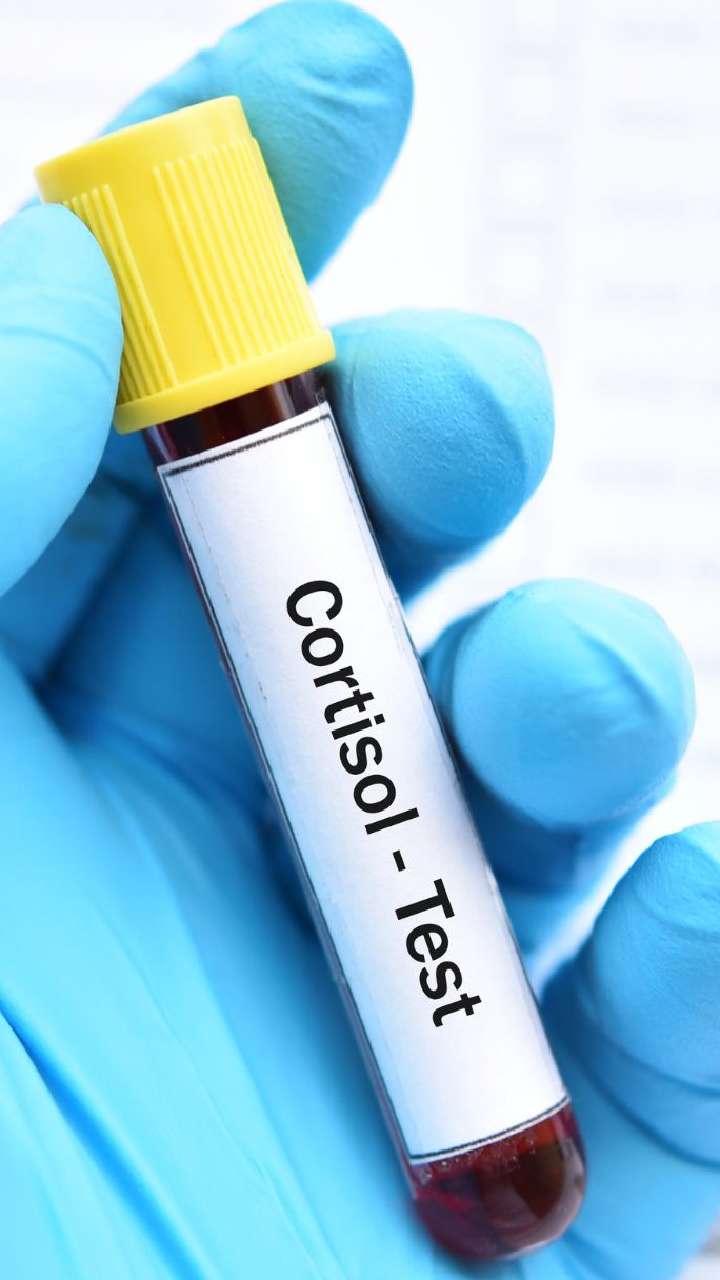 Why Cortisol Makes You Gain Belly Fat?