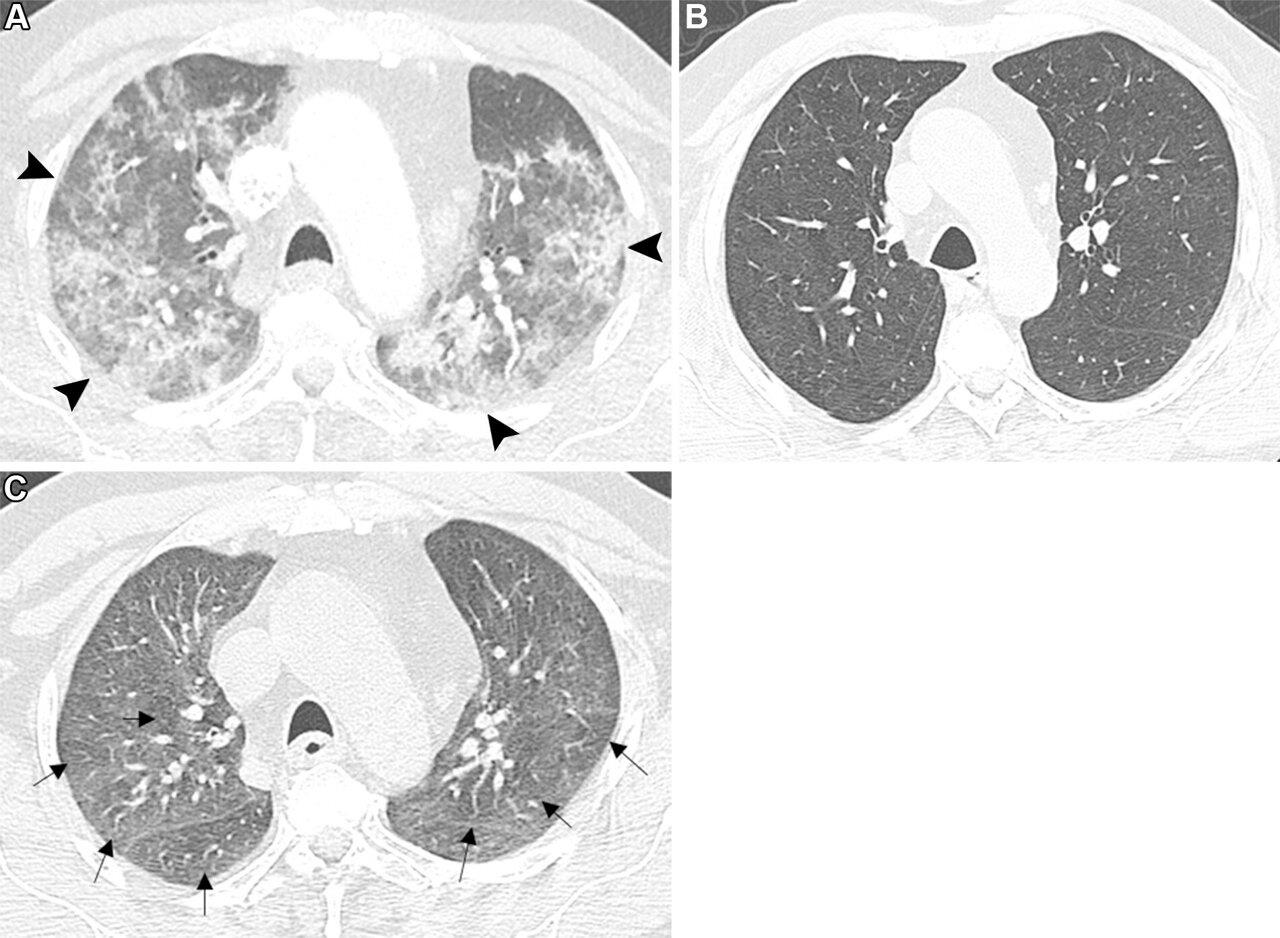 International radiology consensus outlines best practices for post ...