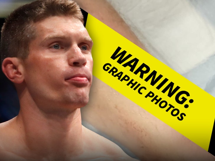 UFC's Stephen Thompson Shows Stitched-Up Leg Gash After Fight Night Injury