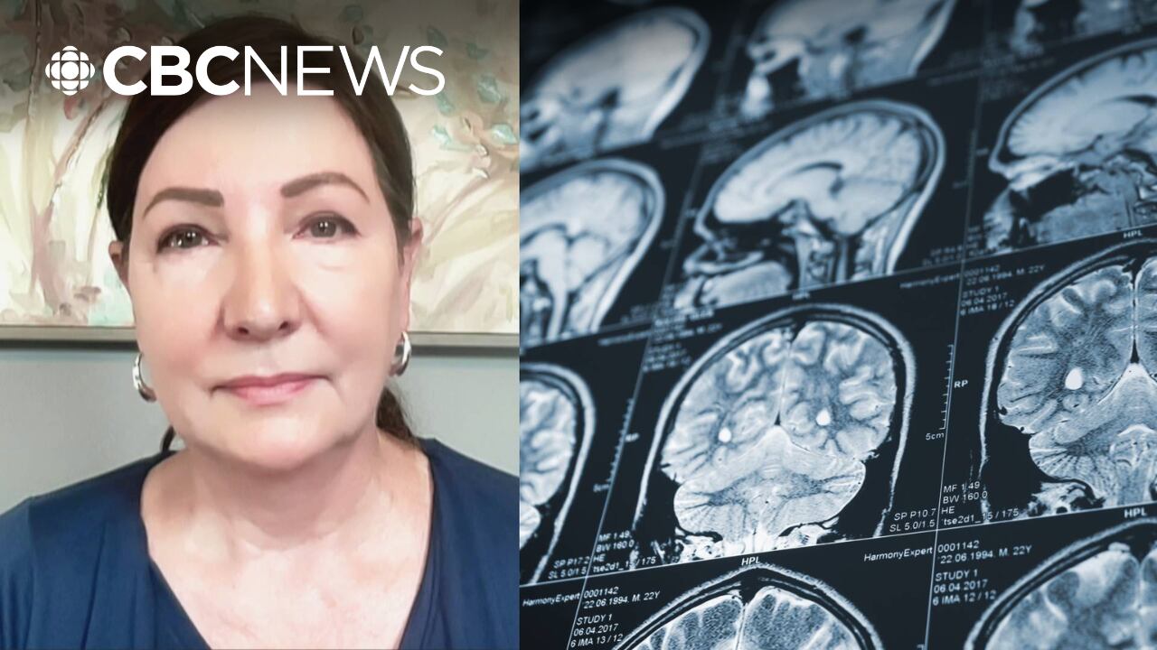 B.C. doctors studying brain injuries in survivors of intimate partner ...