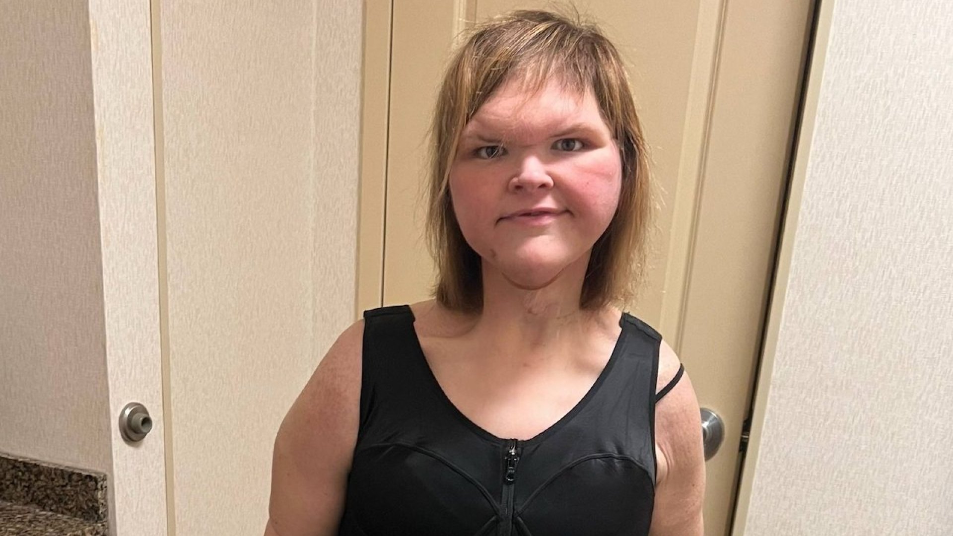 Tammy Slaton Wears Shapewear After Weight Loss, Skin Removal Surgeries