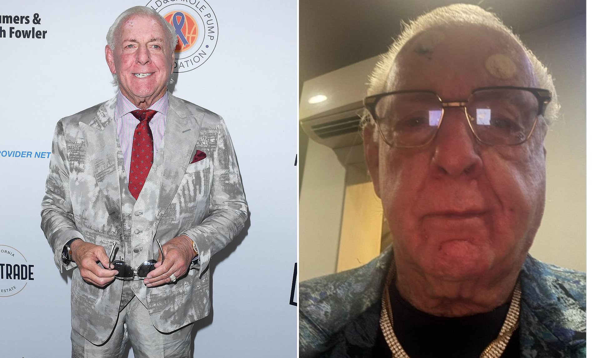 WWE legend Ric Flair, 76, shares major update on skin cancer battle ...