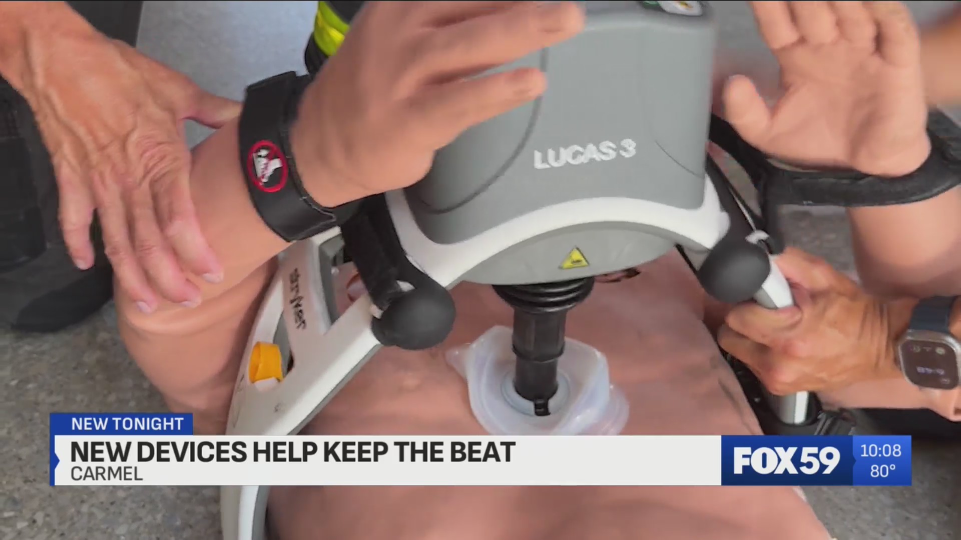 Carmel Fire Department adds LUCAS devices to its ambulances