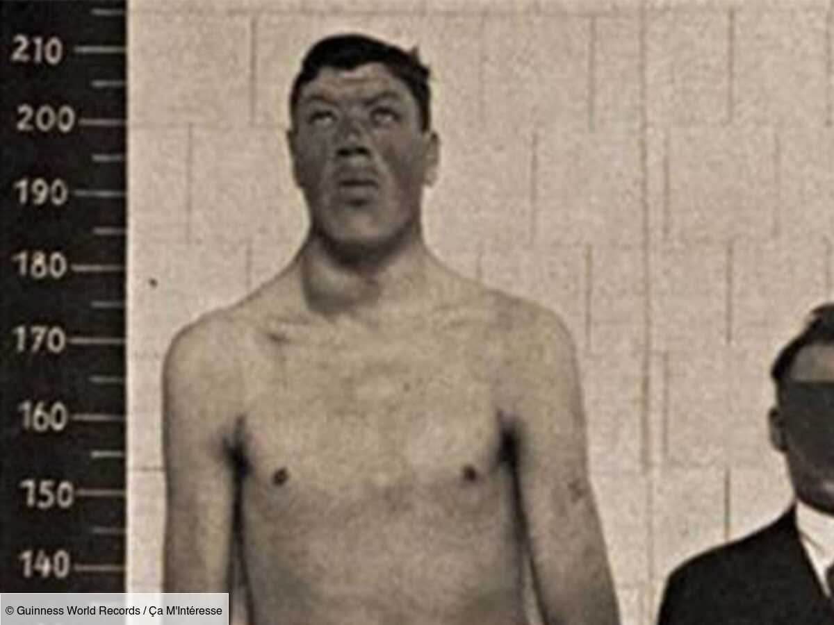 L’histoire incroyable d’Adam Rainer, unique cas de nain devenu géant