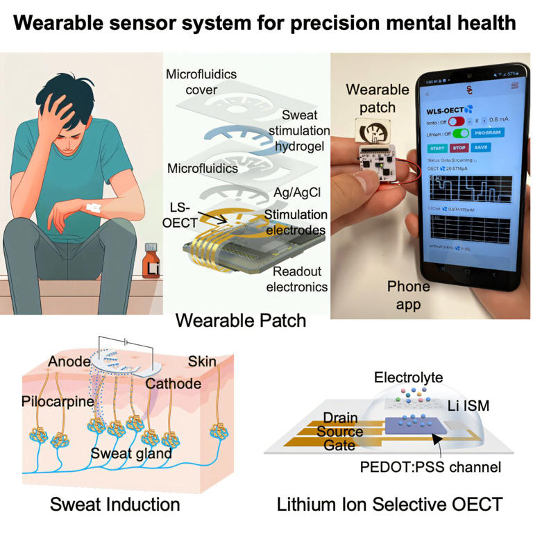 Wearable sensor could help patients with bipolar disorder track ...