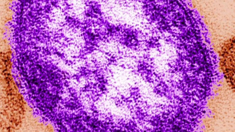 OSDH releases latest measles cases, no new exposures in past 42 days