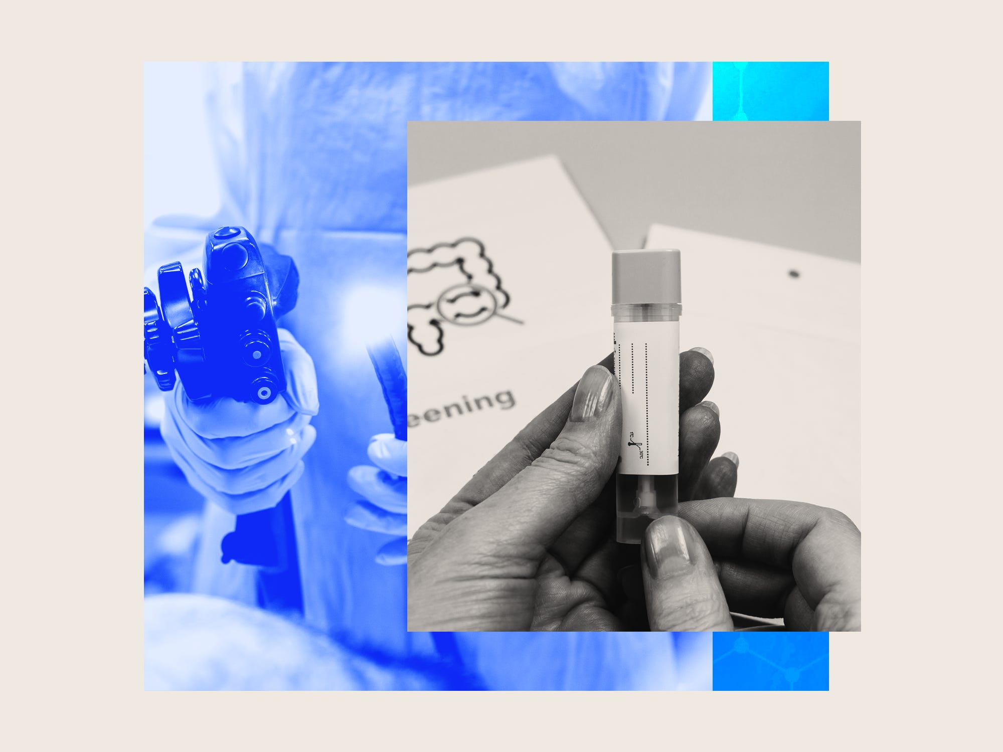 4 easy at-home colon cancer screening tests to check your risk