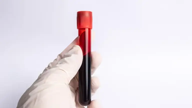 New Blood Group Discovered in India! Unique Blood Type Found in Woman ...