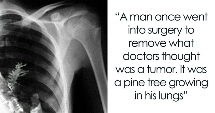 41 Of The Most Disturbing Facts About The World That Might Freak You ...