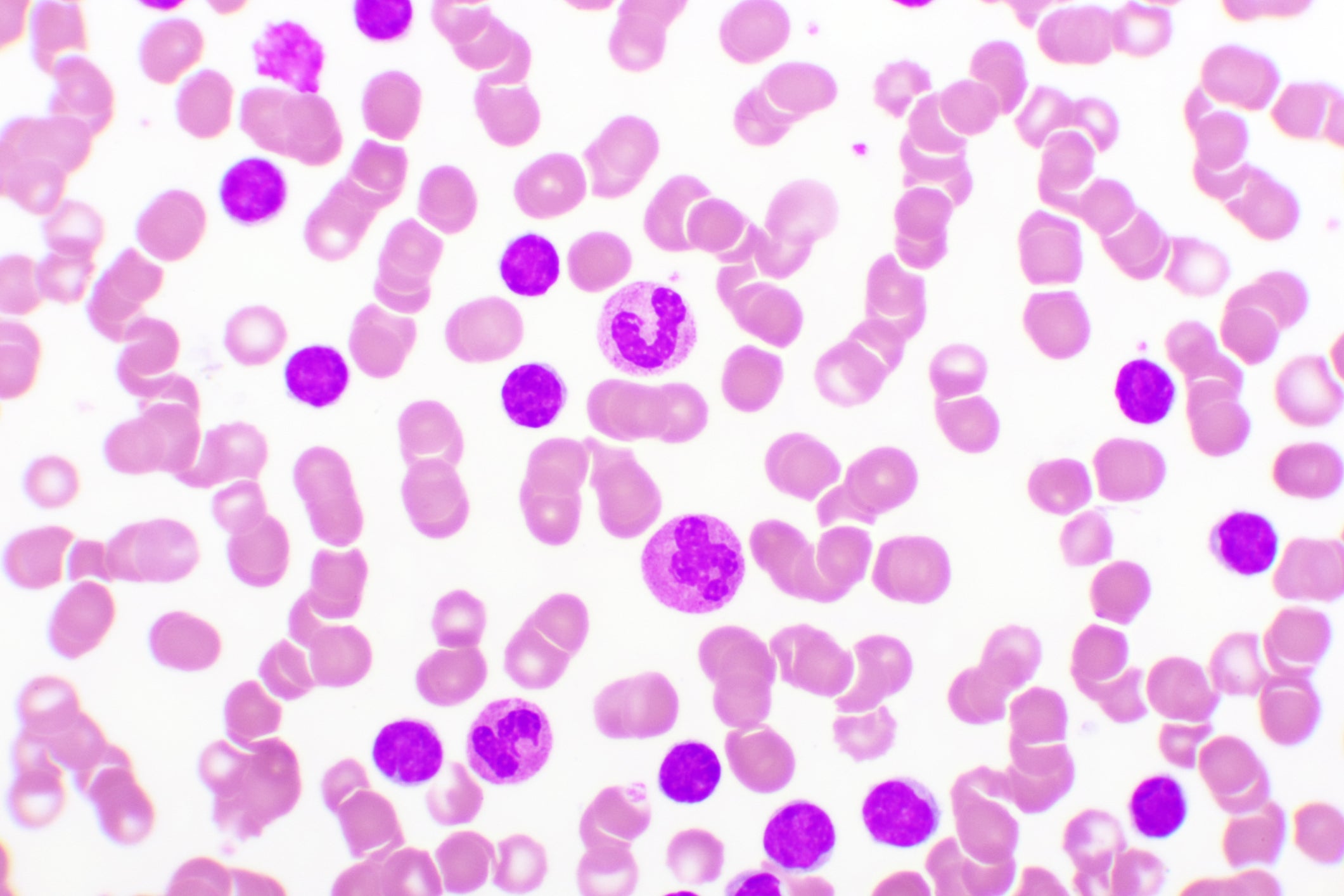 Eli Lilly eyes SoC status as Jaypirca proves superior to Imbruvica in ...