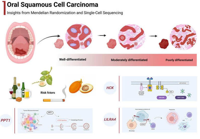 Three genes may hold the key to treating deadly oral cancer