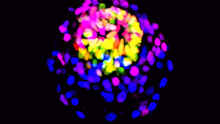 Lab-grown embryo models are getting more realistic. Scientists are ...