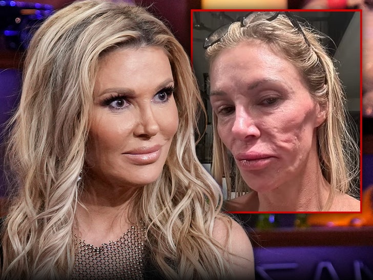 Brandi Glanville Says She's Finally Getting Answers About Her Facial ...