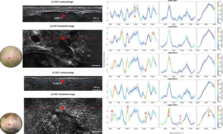 Dual-mode optical imaging system offers new noninvasive approach to ...